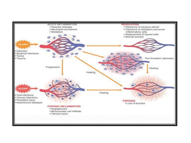 Inflammation part 1 | PPT