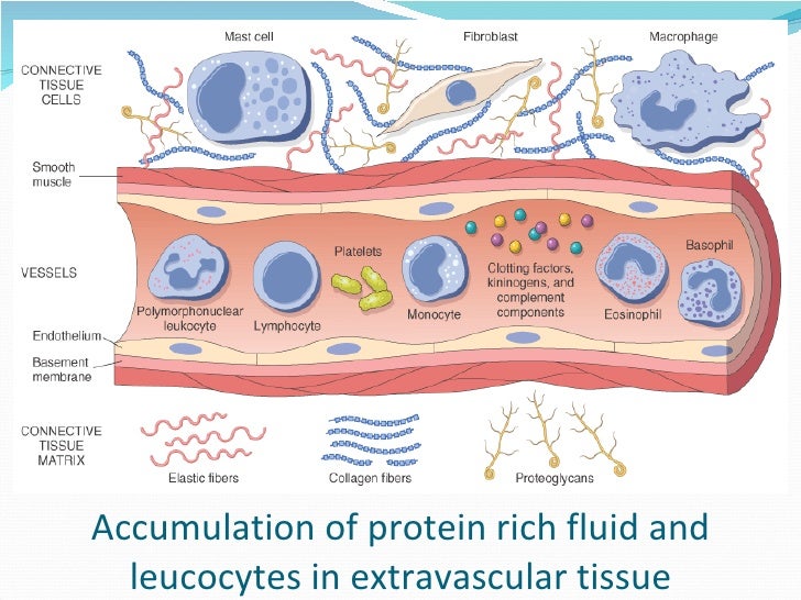 Inflammation reza2003 e video