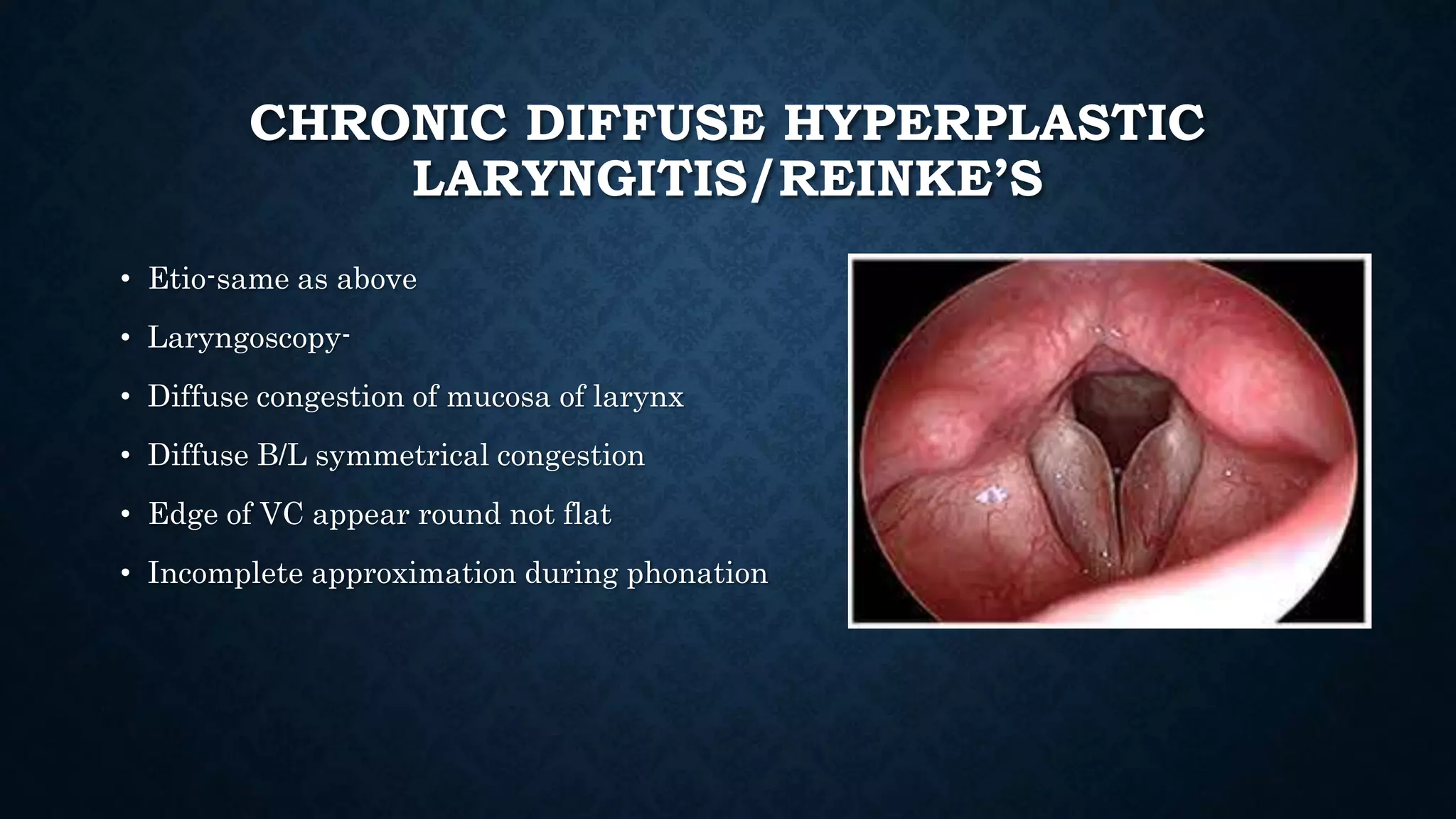 Inflammations of larynx.pptx