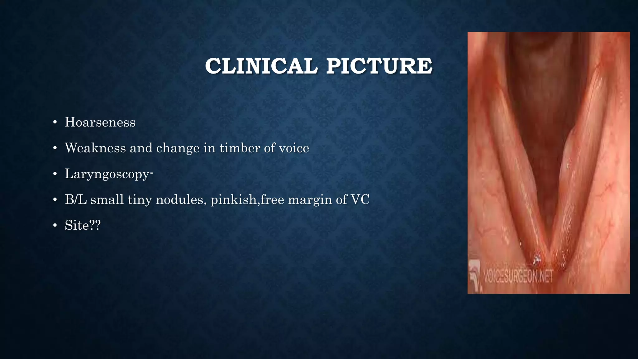 Inflammations of larynx.pptx