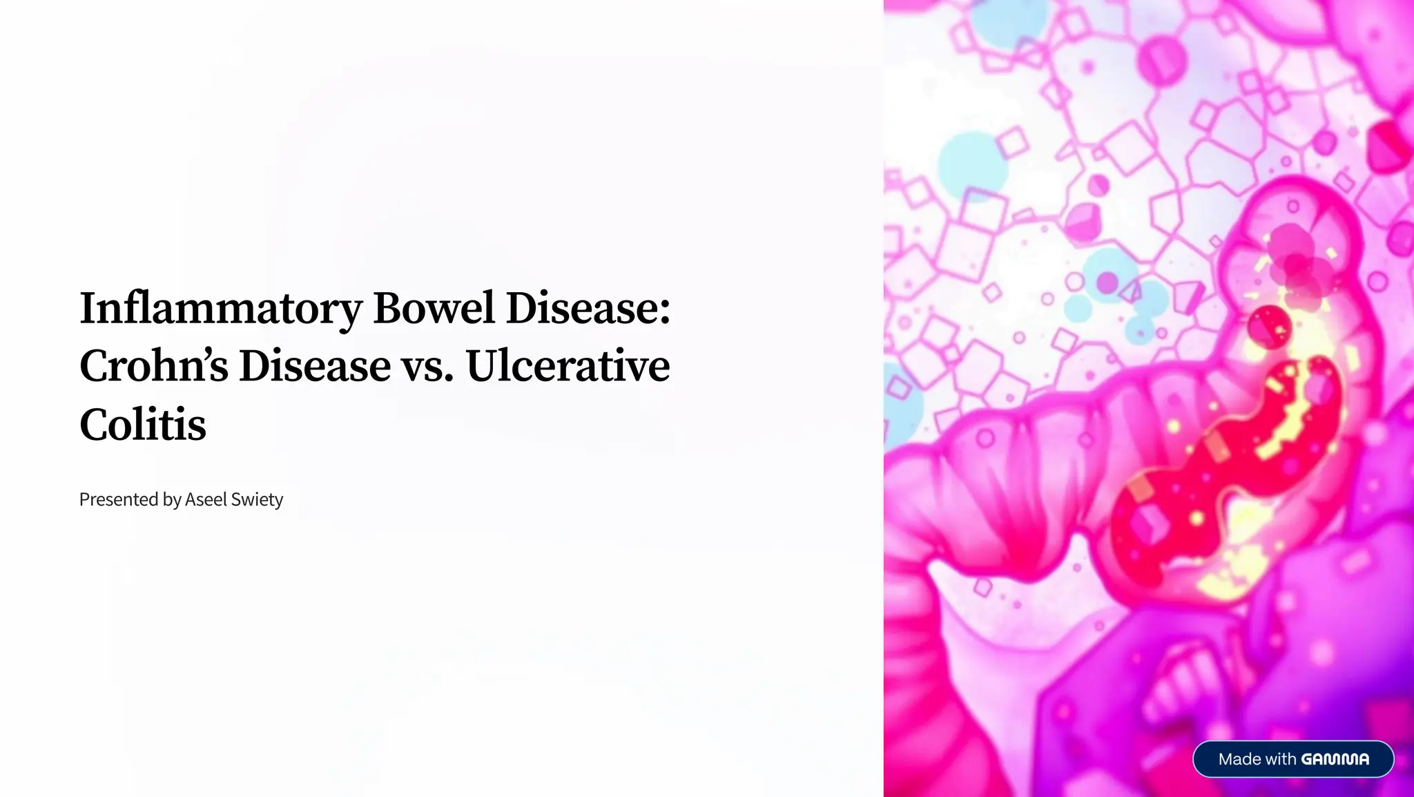 Inflammatory-Bowel-Disease-Crohns-Disease-vs-Ulcerative-Colitis ...