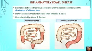 Inflammatory-bowel-disease-pathogenesis.ppt