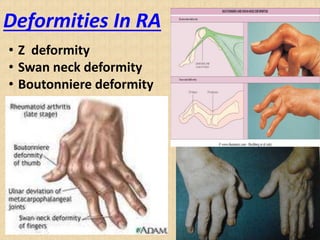 inflammatoryarthritis-170820154705 (1).pdf | Bone and Joint Conditions ...