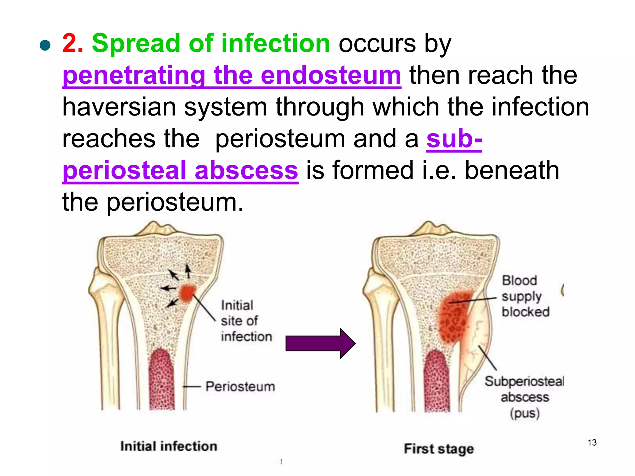 Inflammatory bone diseases & bone fracture_Dr.Manal Ismail Abd-Elghany ...