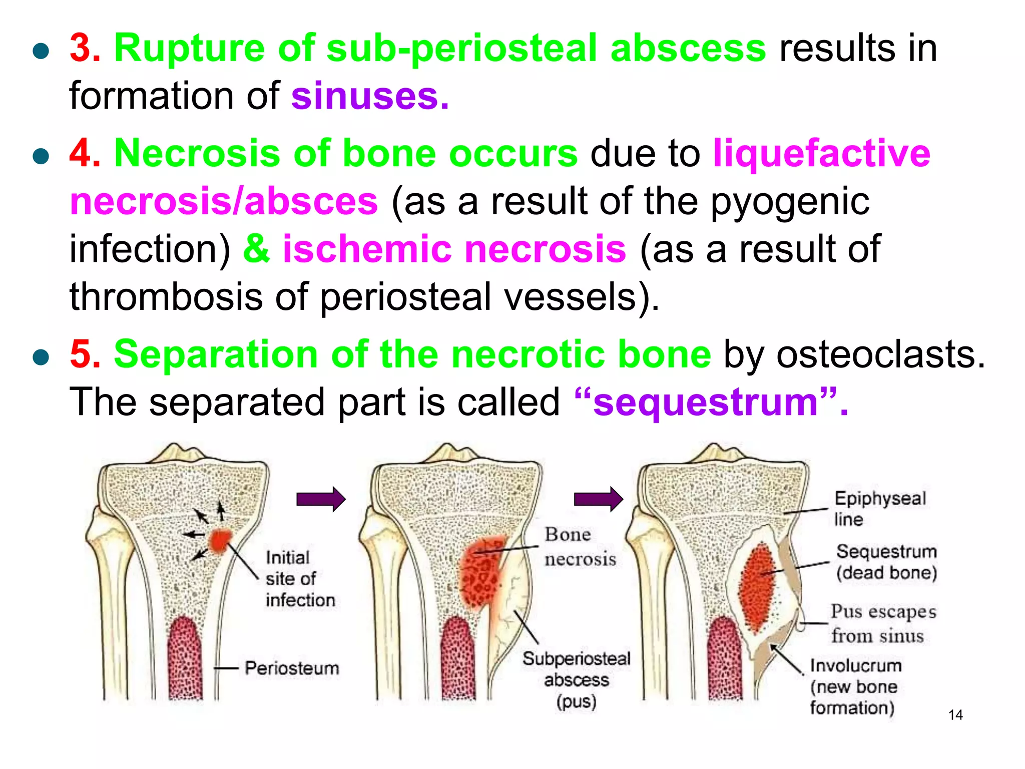 Inflammatory bone diseases & bone fracture_Dr.Manal Ismail Abd-Elghany ...