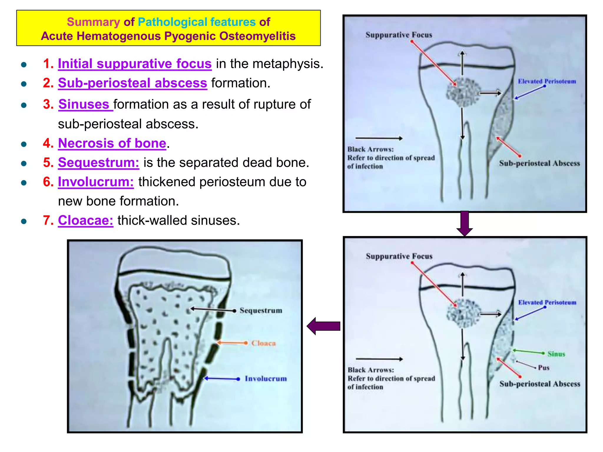 Inflammatory bone diseases & bone fracture_Dr.Manal Ismail Abd-Elghany ...