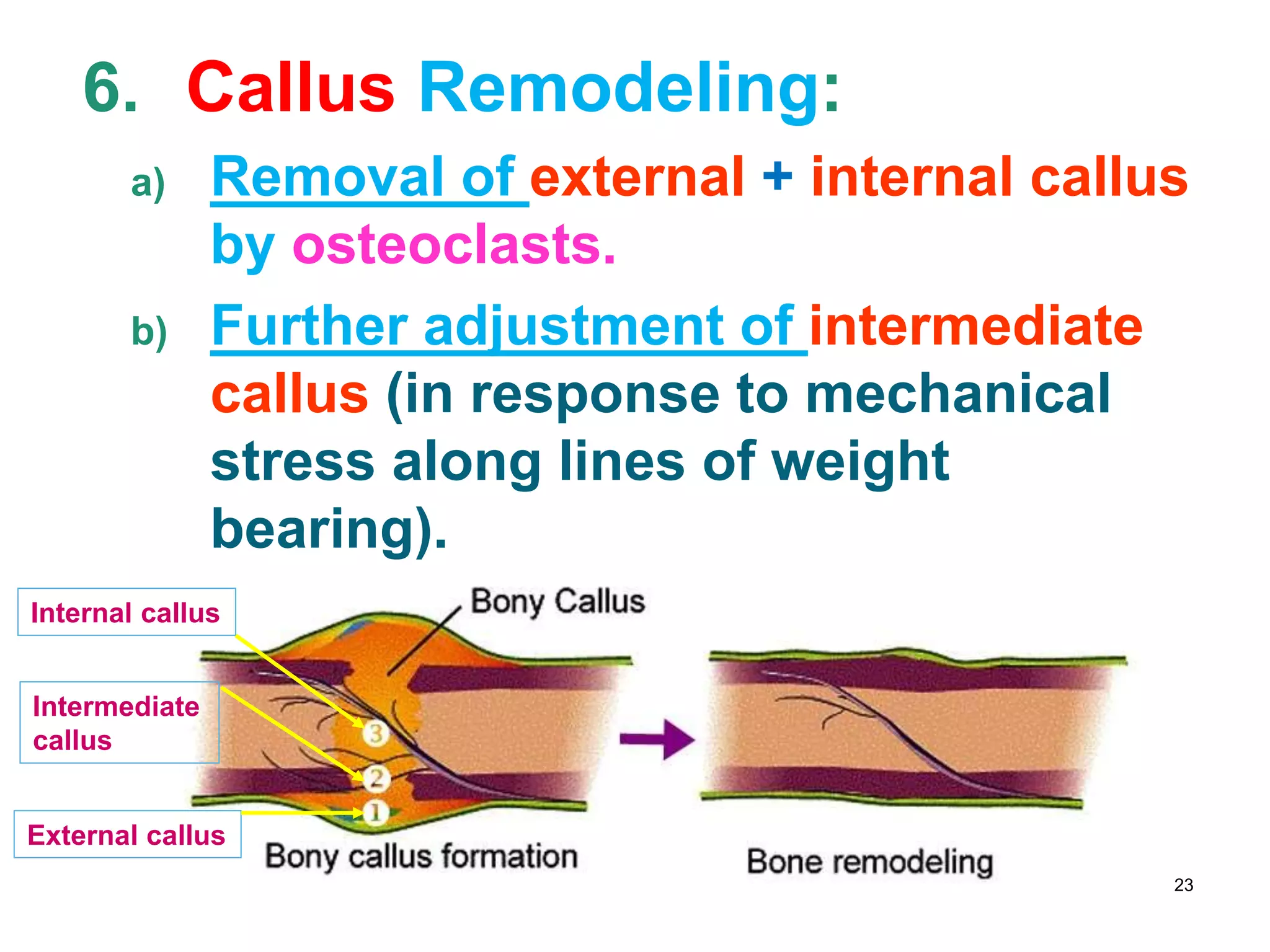 Inflammatory bone diseases & bone fracture_Dr.Manal Ismail Abd-Elghany ...