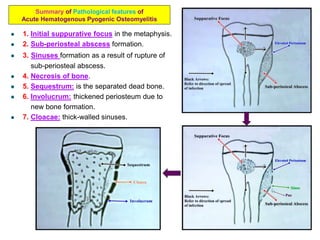 Inflammatory bone diseases & bone fracture_Dr.Manal Ismail Abd-Elghany ...