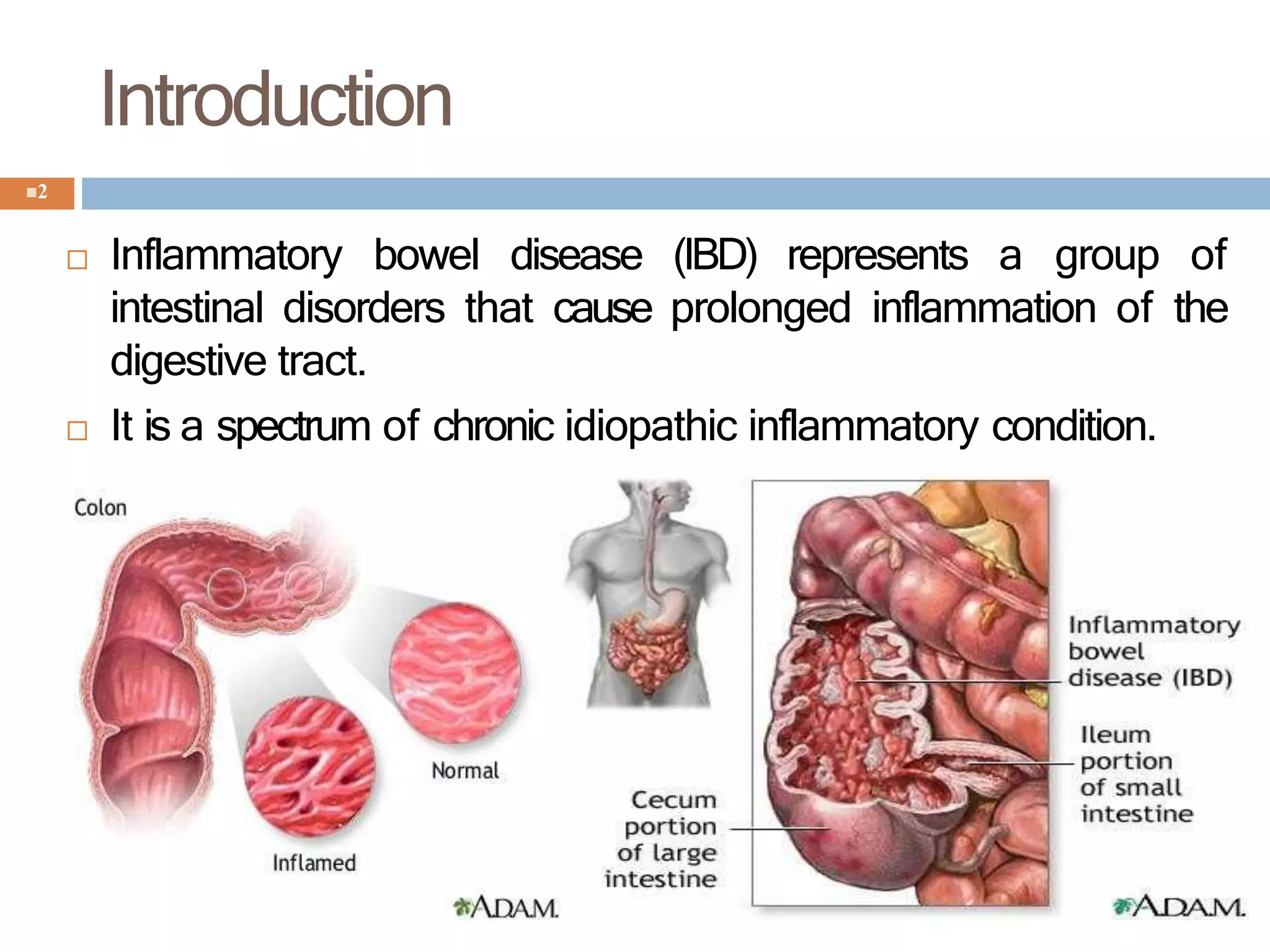 inflammatory bowel diseas.pptx
