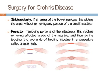 inflammatory bowel diseas.pptx