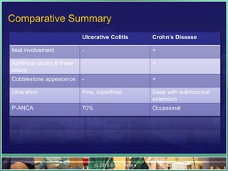 Inflammatory Bowel Disease | PPTX | Digestive Disorders | Diseases and ...