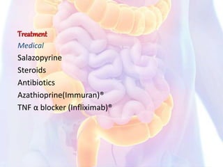 Inflammatory bowel disease | PPT