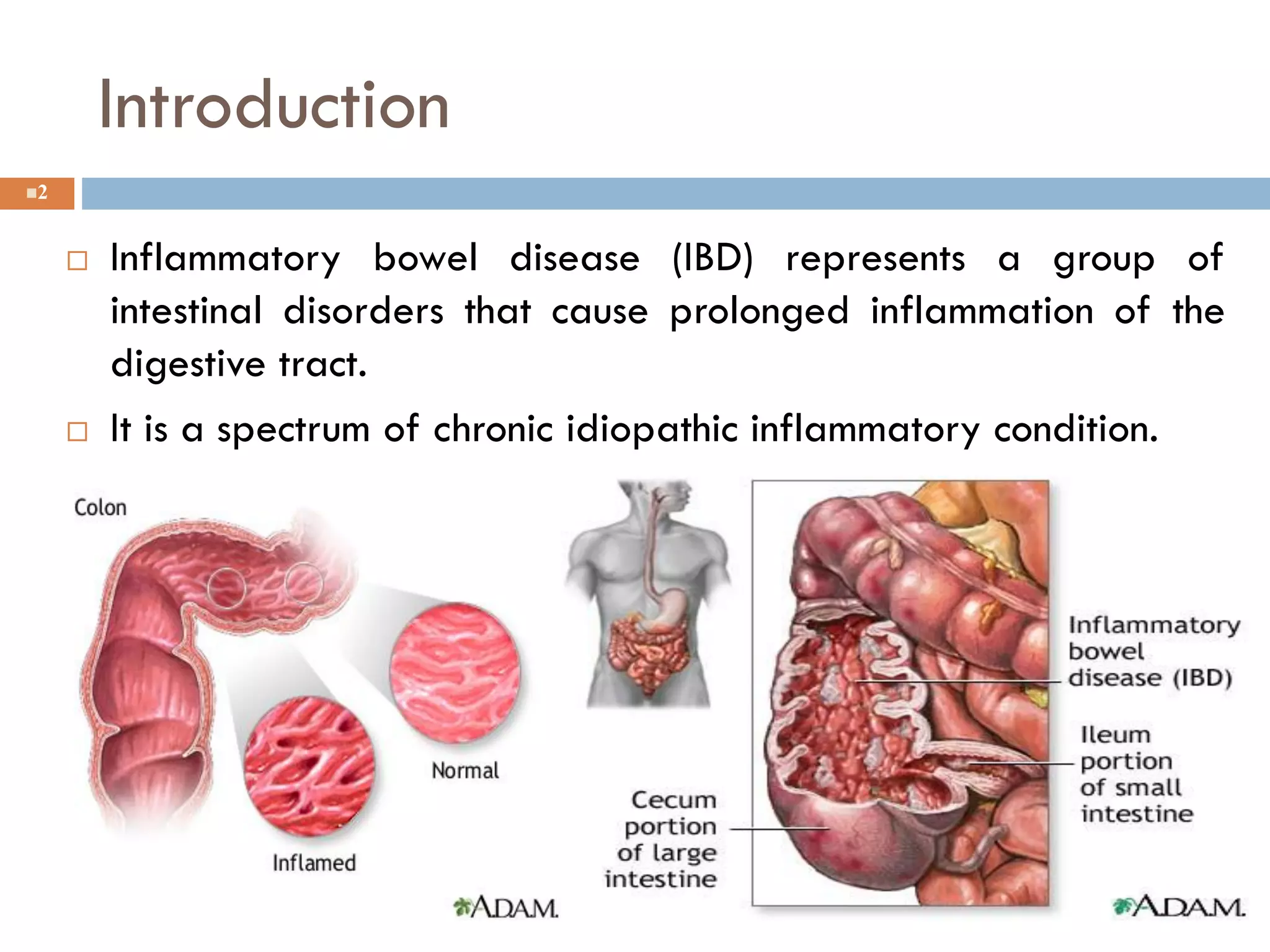 Inflammatory bowel disease | PDF