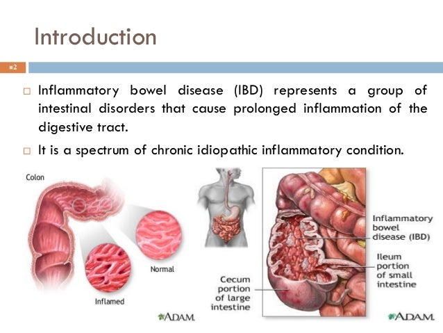 Inflammatory bowel disease
