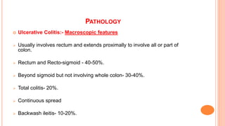 Inflammatory bowel disease | PPTX
