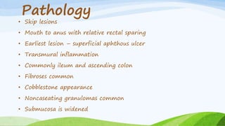 CROHN'S DISEASE | PPTX