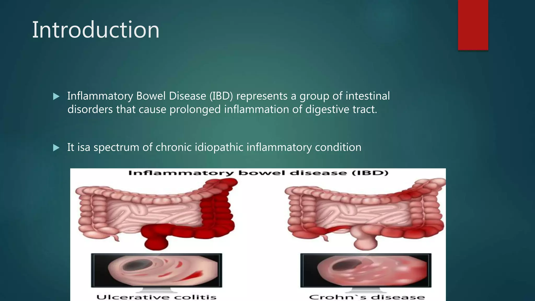 inflammatory bowel disease.pptx