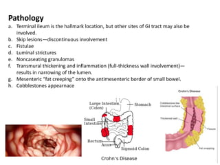 Inflammatory Bowel Disease.pptx