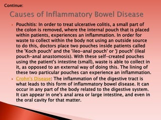 Inflammatory bowel disease (ibd) | PPT