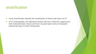 Inflammatory bowel disease imaging | PPTX