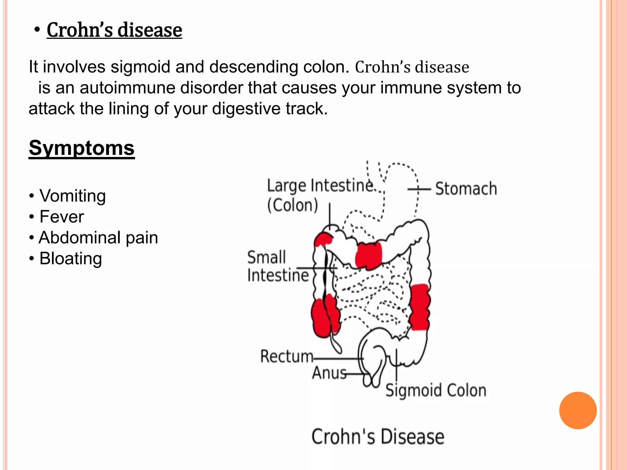 Inflammatory bowel disease ppt..pptx