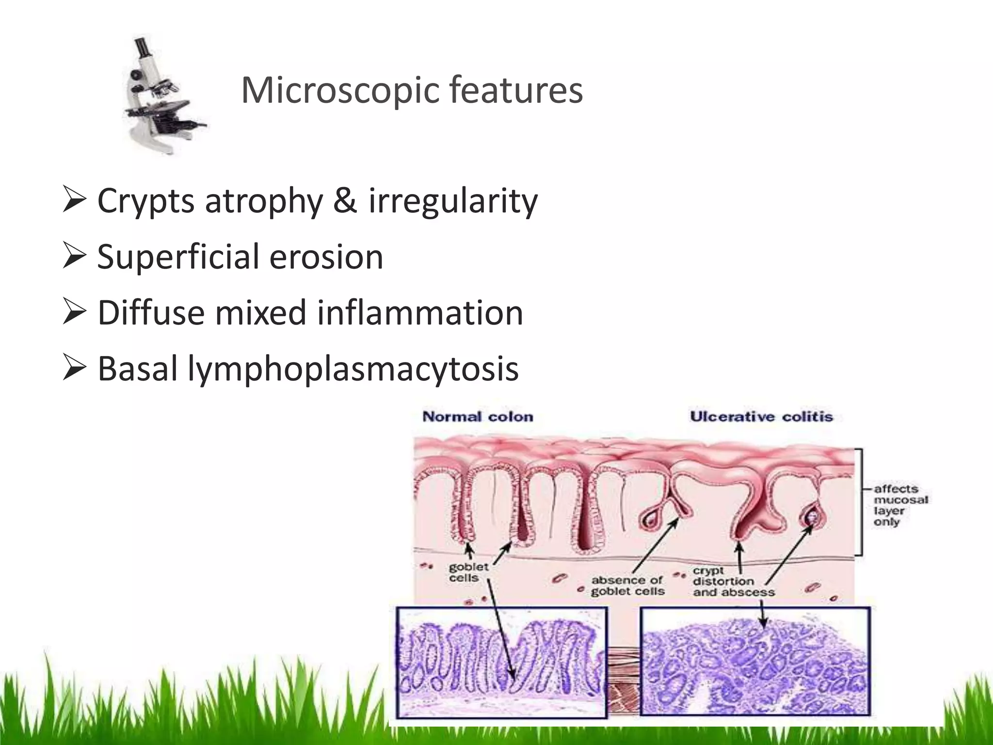 Inflammatory bowel diseases | PPTX