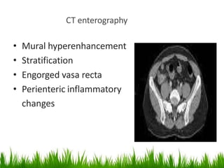 Inflammatory bowel diseases | PPTX
