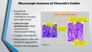 INFLAMMATORY BOWEL DISEASE Crohns and ulcerative coliits | PPTX