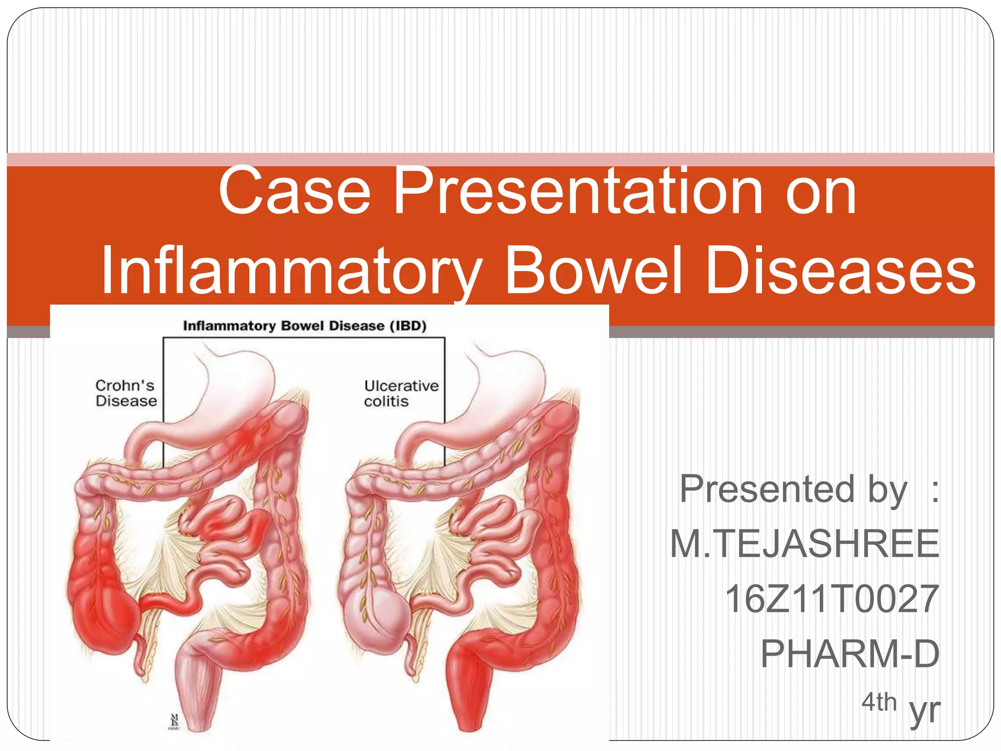 Inflammatory bowel diseases | PPT
