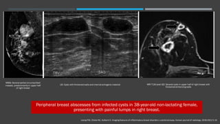 inflammatory breast disease (Handout).pdf