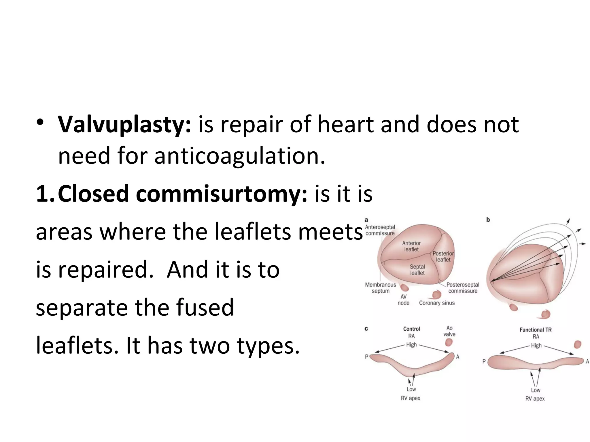 Inflammatory cardiac disorders | PPT