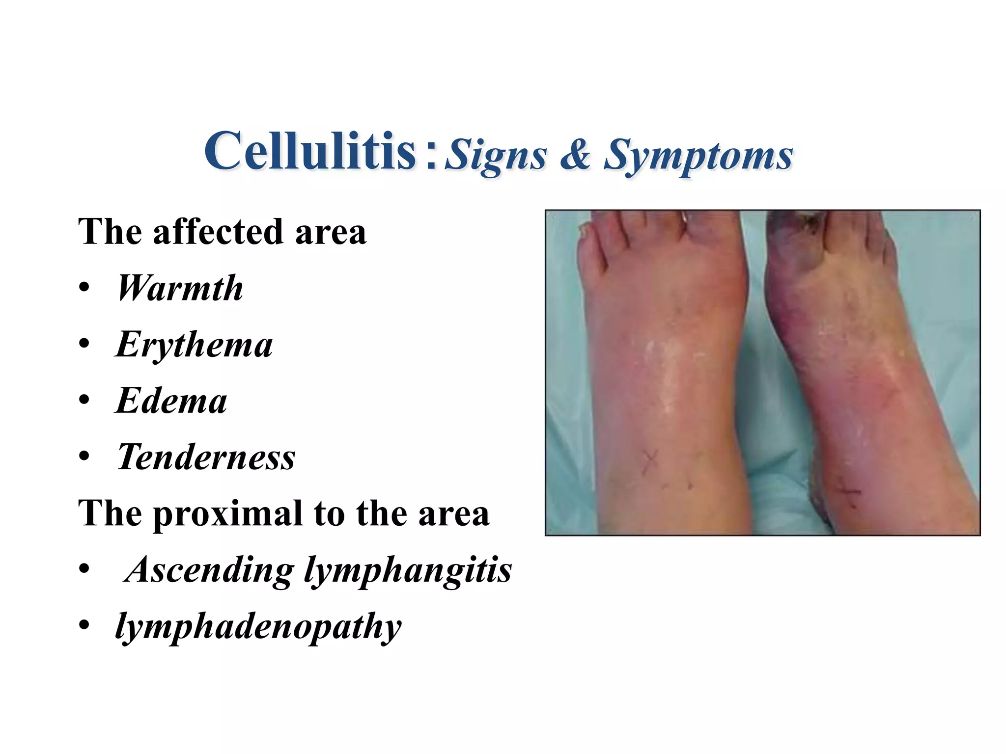 Inflammatory conditions of skin | PPTX