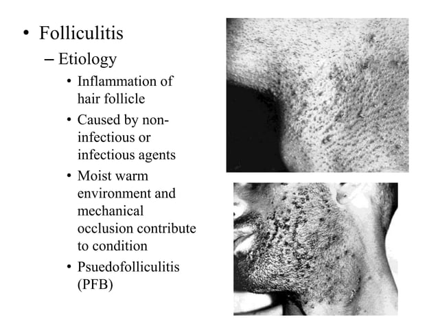 Inflammatory conditions of skin | PPTX | Skin and Dermatology ...