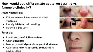 INFLAMMATORY DISEASES OF NOSE (INCLUDING Atrophic rhinitis, Allergic ...