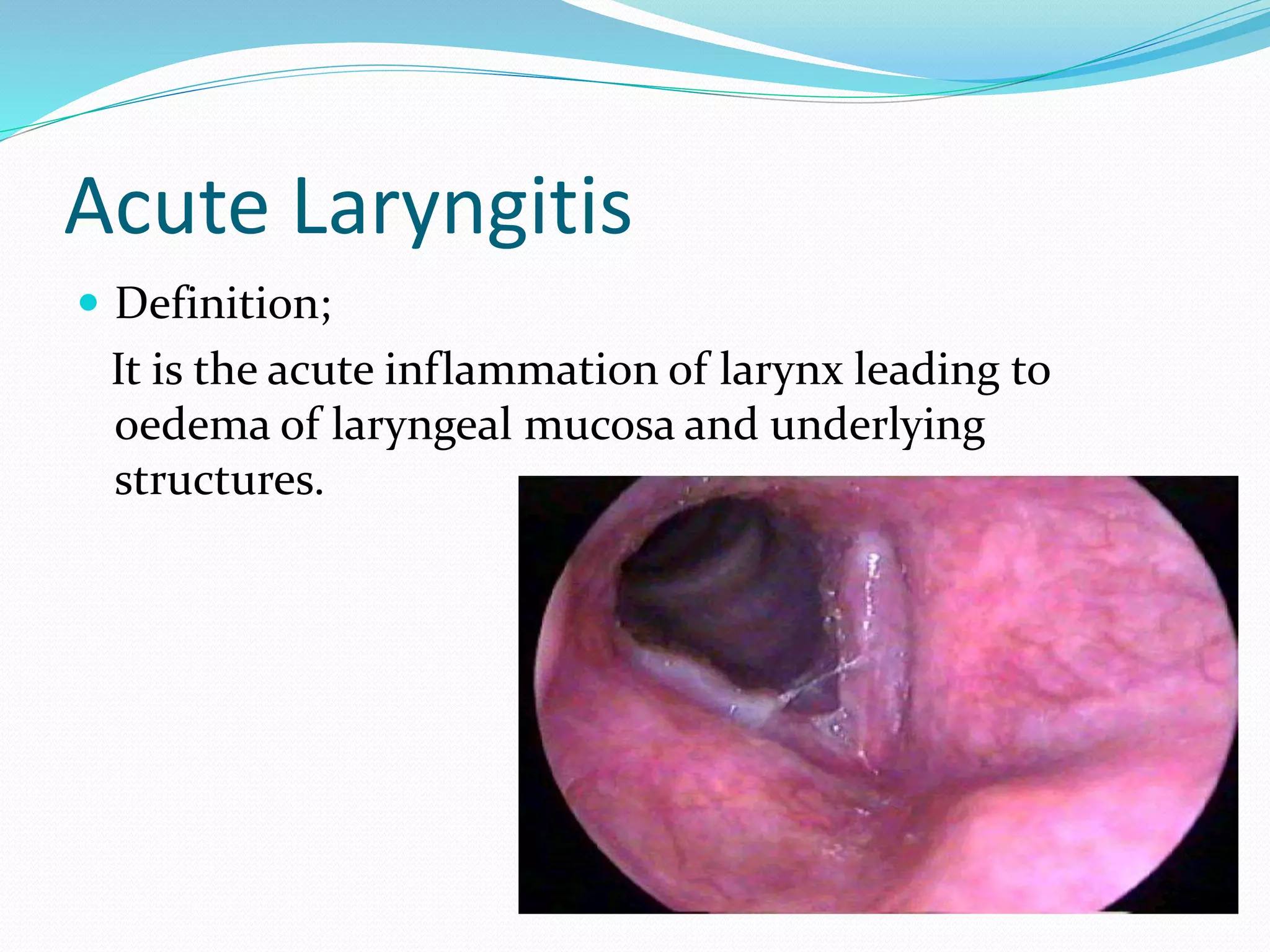 Inflammatory disorders of larynx [autosaved] | PPTX