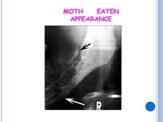 inflammatory Jaw lesions.ppt