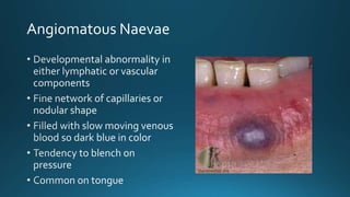Inflammatory overgrowths | PPTX