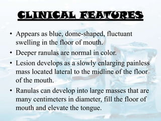 Inflammatory pappilary hyperplasia & ranula | PPTX
