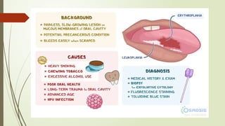 INFLAMMATORY & ULCERATIVE LESIONS OF ORAL CAVITY SGD.pptx