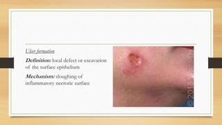 Inflammtion 4 | PPTX