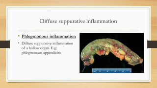 Inflammtion 4 | PPTX