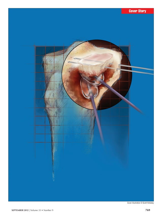 Inflation osteoplasty | PDF