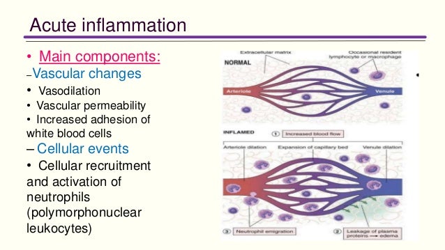 Inflammation