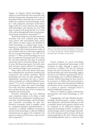Inflicted childhood neurotrauma (shaken baby syndrome) ophthalmic ...