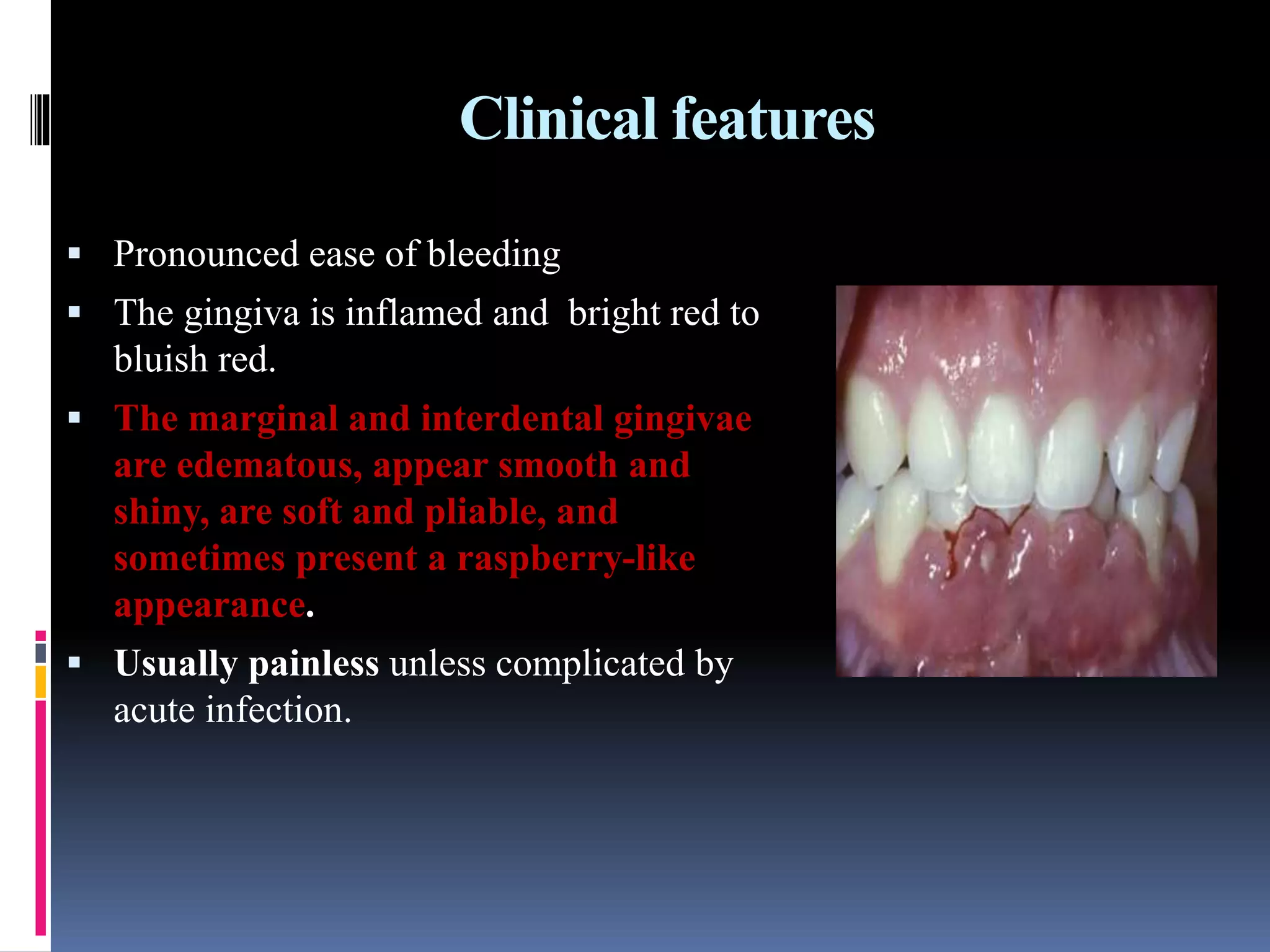 Influence of systemic conditions on the periodontium | PPTX