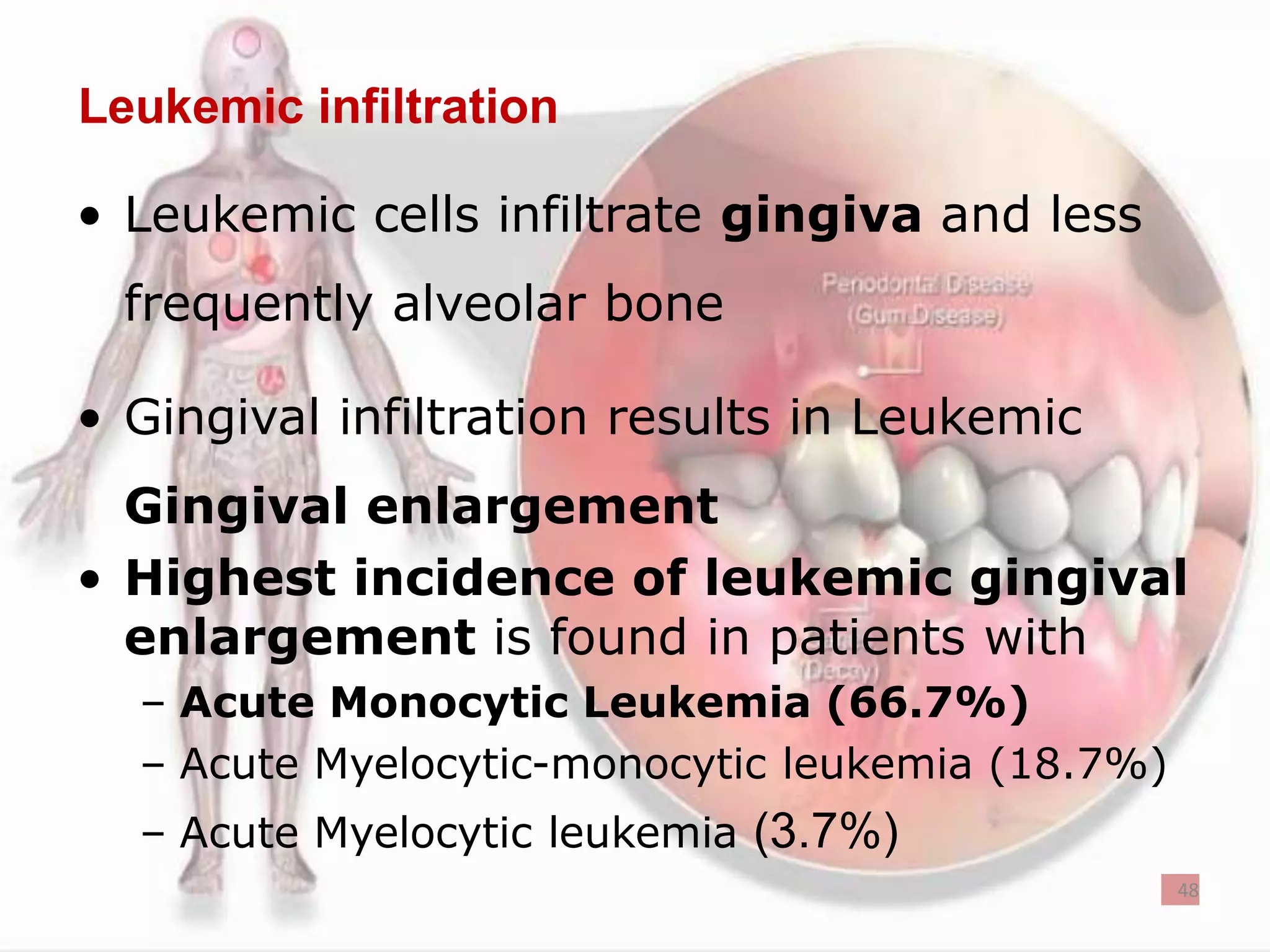 Influence of systemic diseases on periodontium. | PPTX