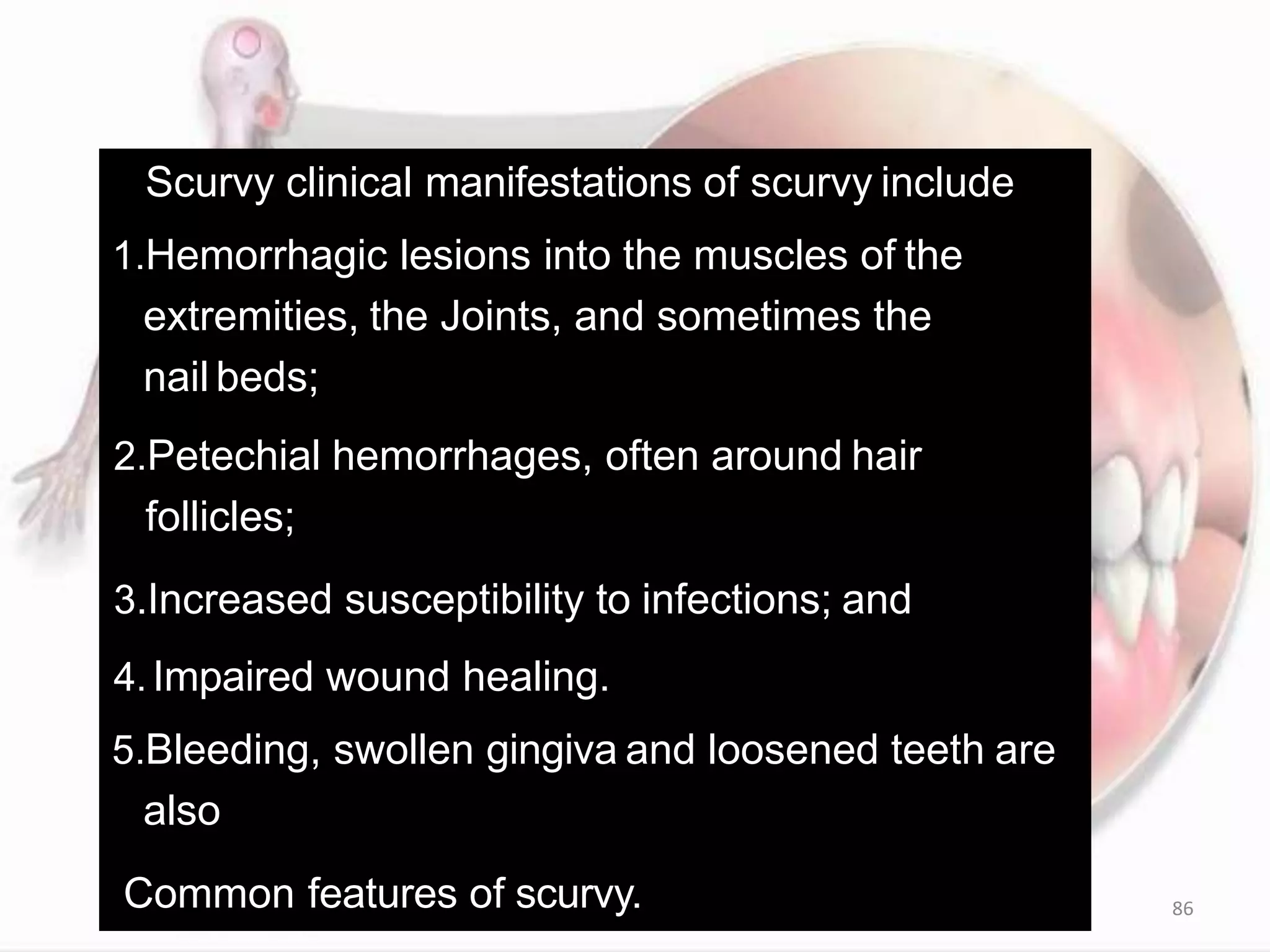 Influence of systemic diseases on periodontium. | PPTX