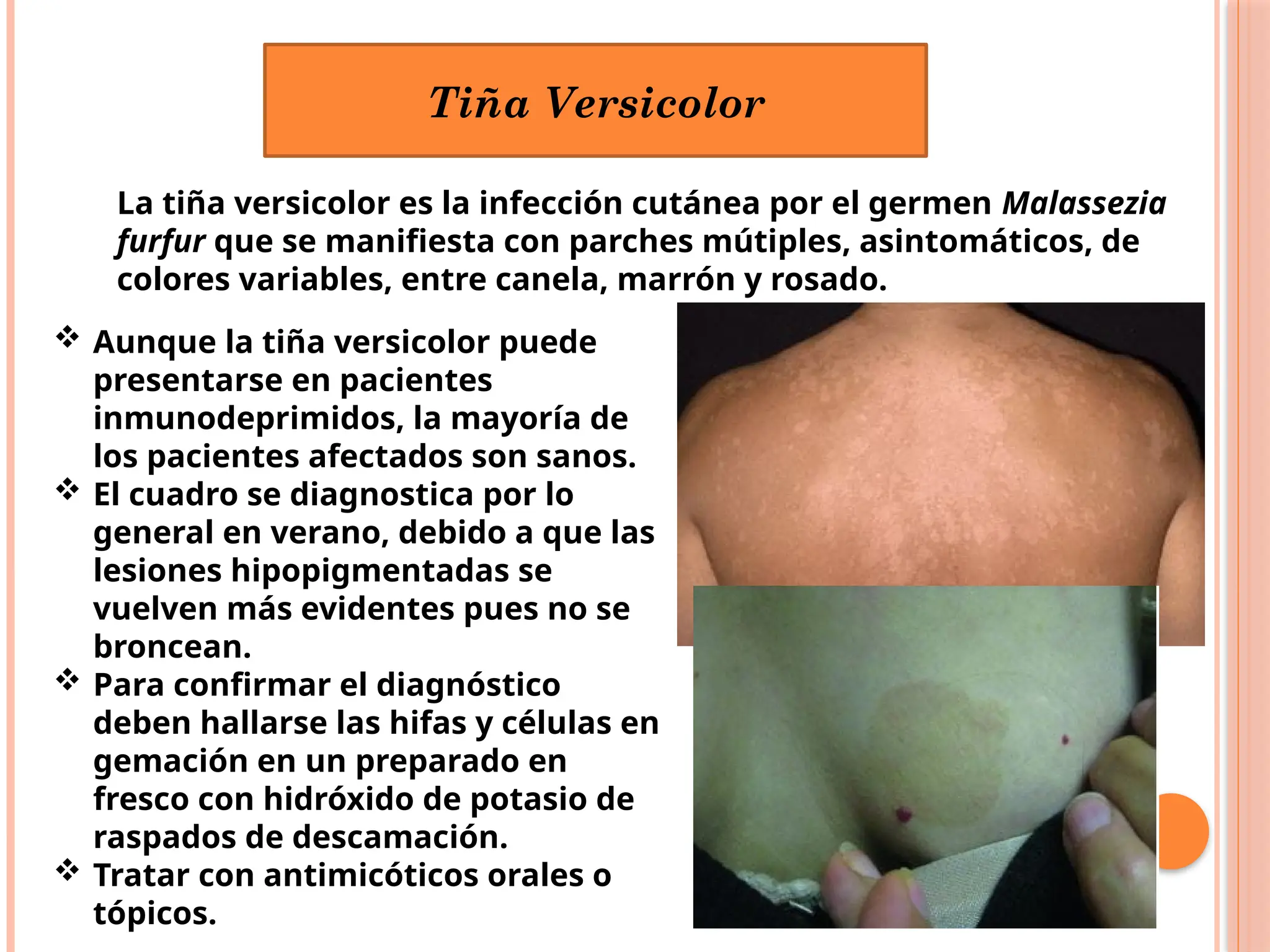 enfermedades micoticas de la piel, contenido amplio | PPTX