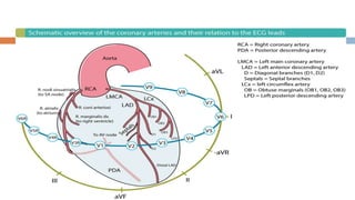 Inf MI with RVMI by Dr. Jahangir Alam (1).pptx
