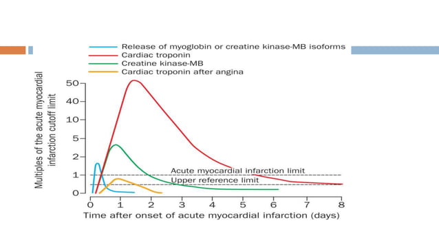 Inf MI with RVMI by Dr. Jahangir Alam (1).pptx